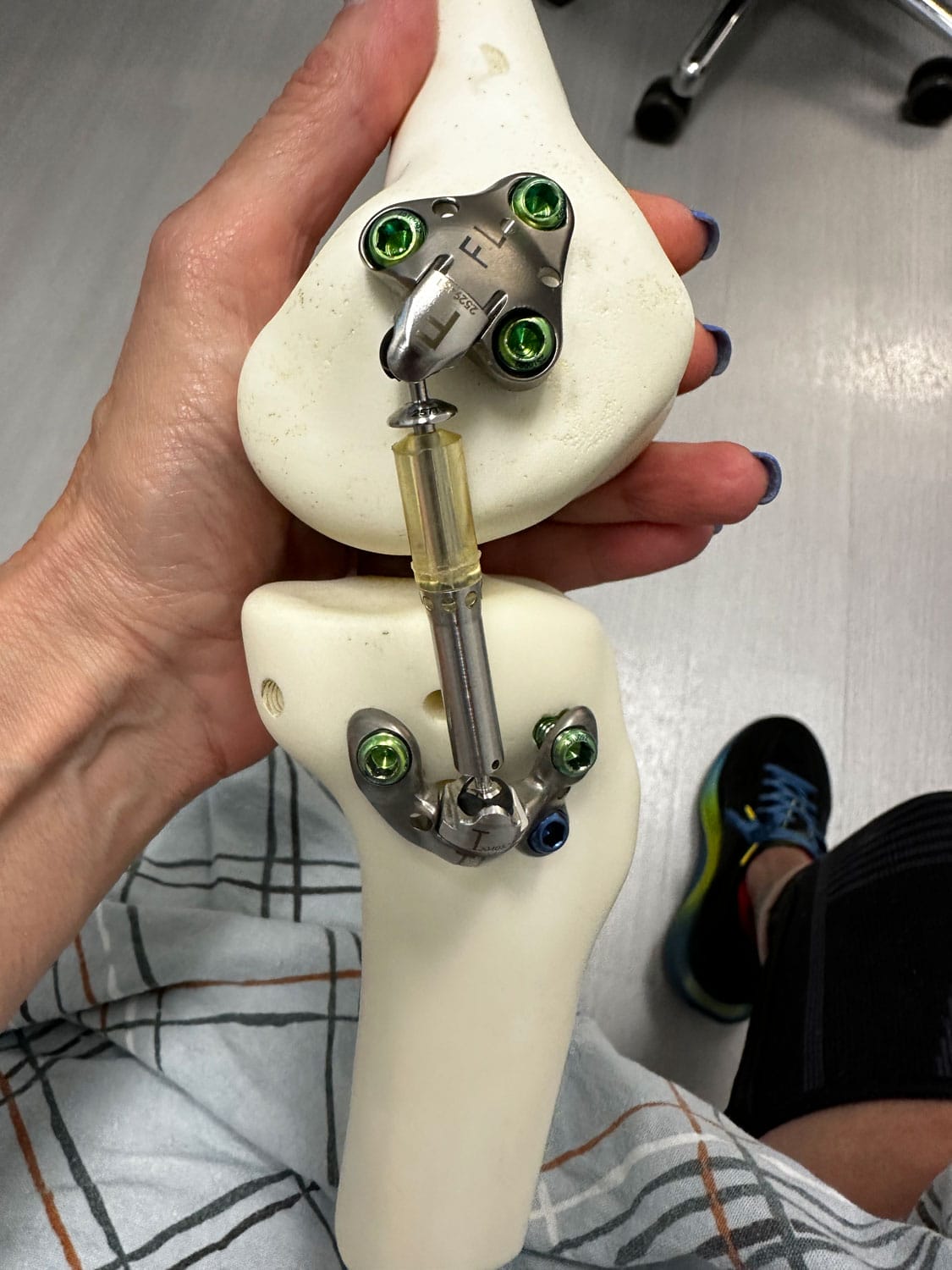 Should I Get a Partial Knee Replacement or a Misha Knee Unit? - A ...